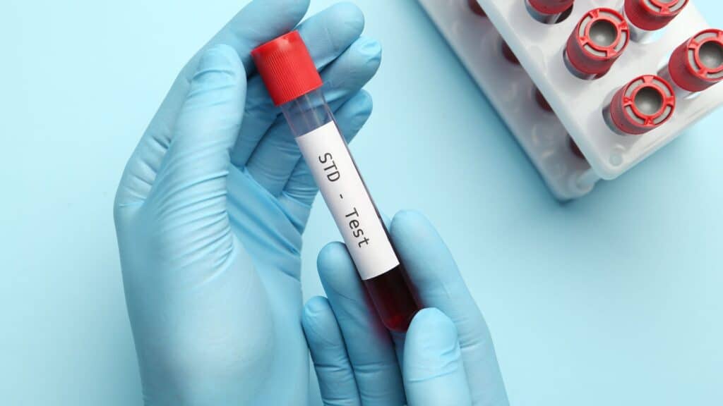 Getting an STD Test in Bangkok: What to Expect and Where to Go | H.U.M ...
